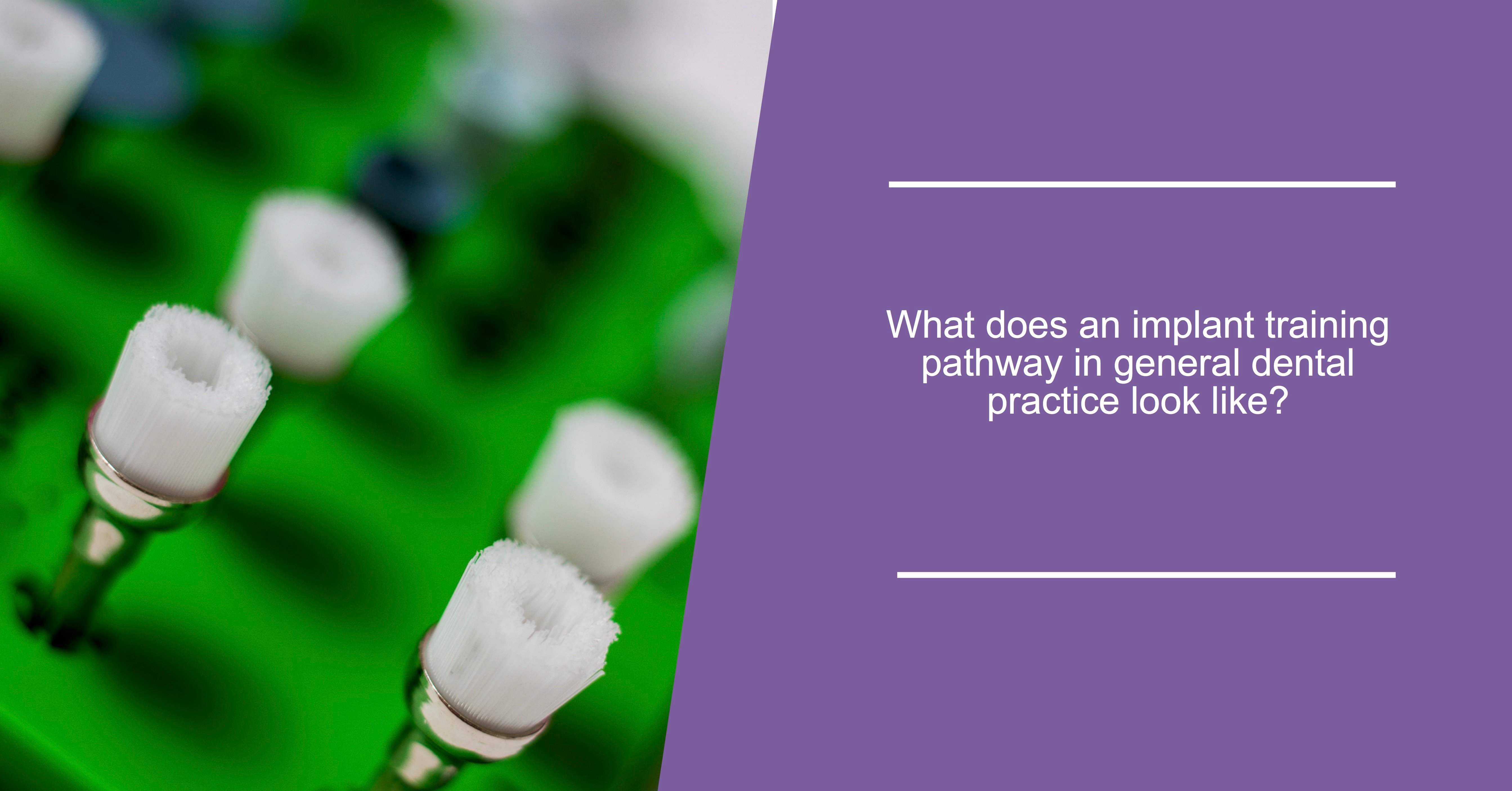 The Pathways to Choose From After Completing Dental Implant Courses